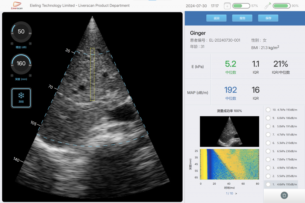 Liverscan, the world’s first handheld wireless liver biopsy instrument ...